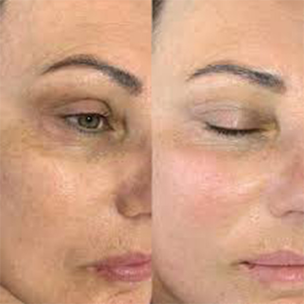 Bioplacenta Plus – Márcia Arieta